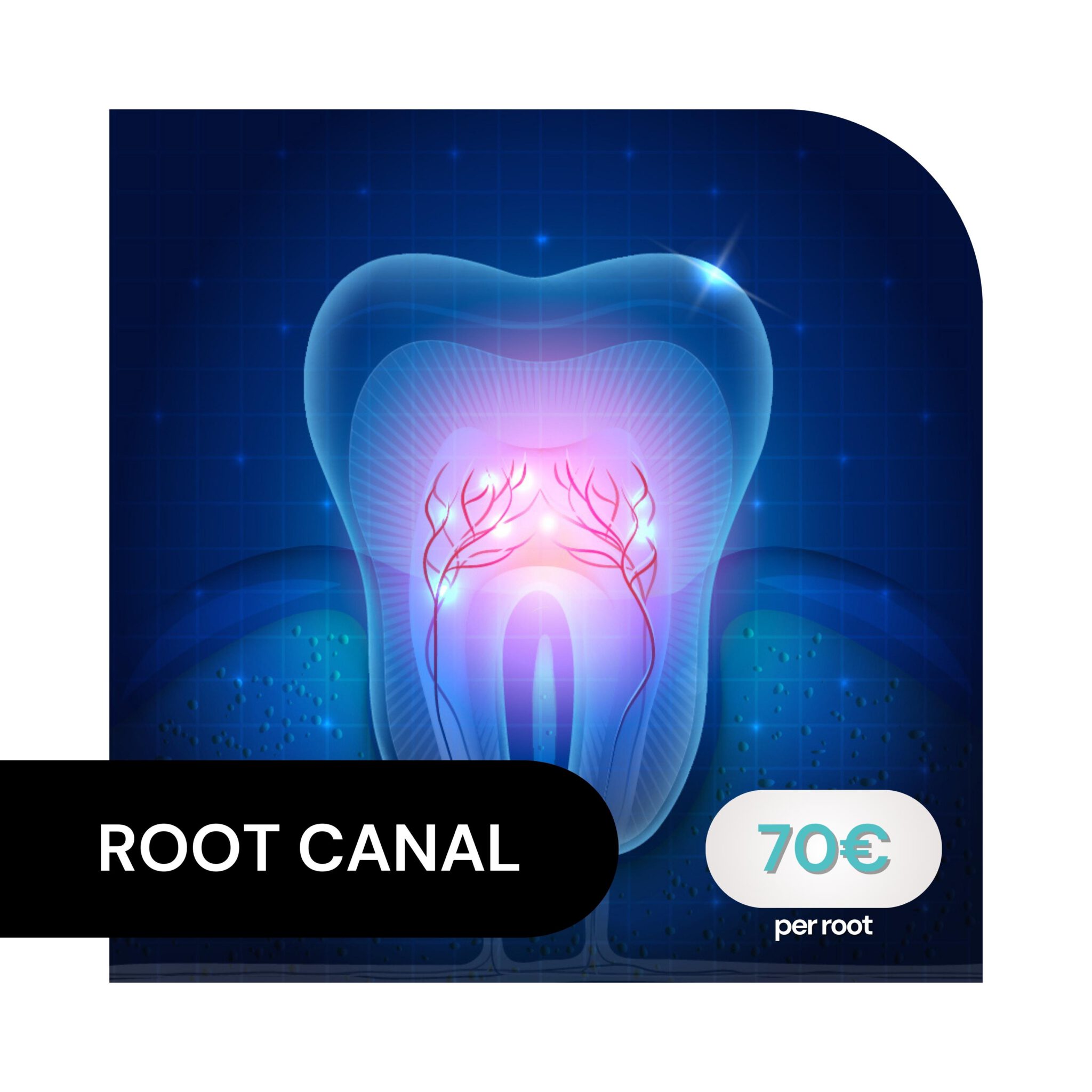 Root Canal – Smile in Turkey