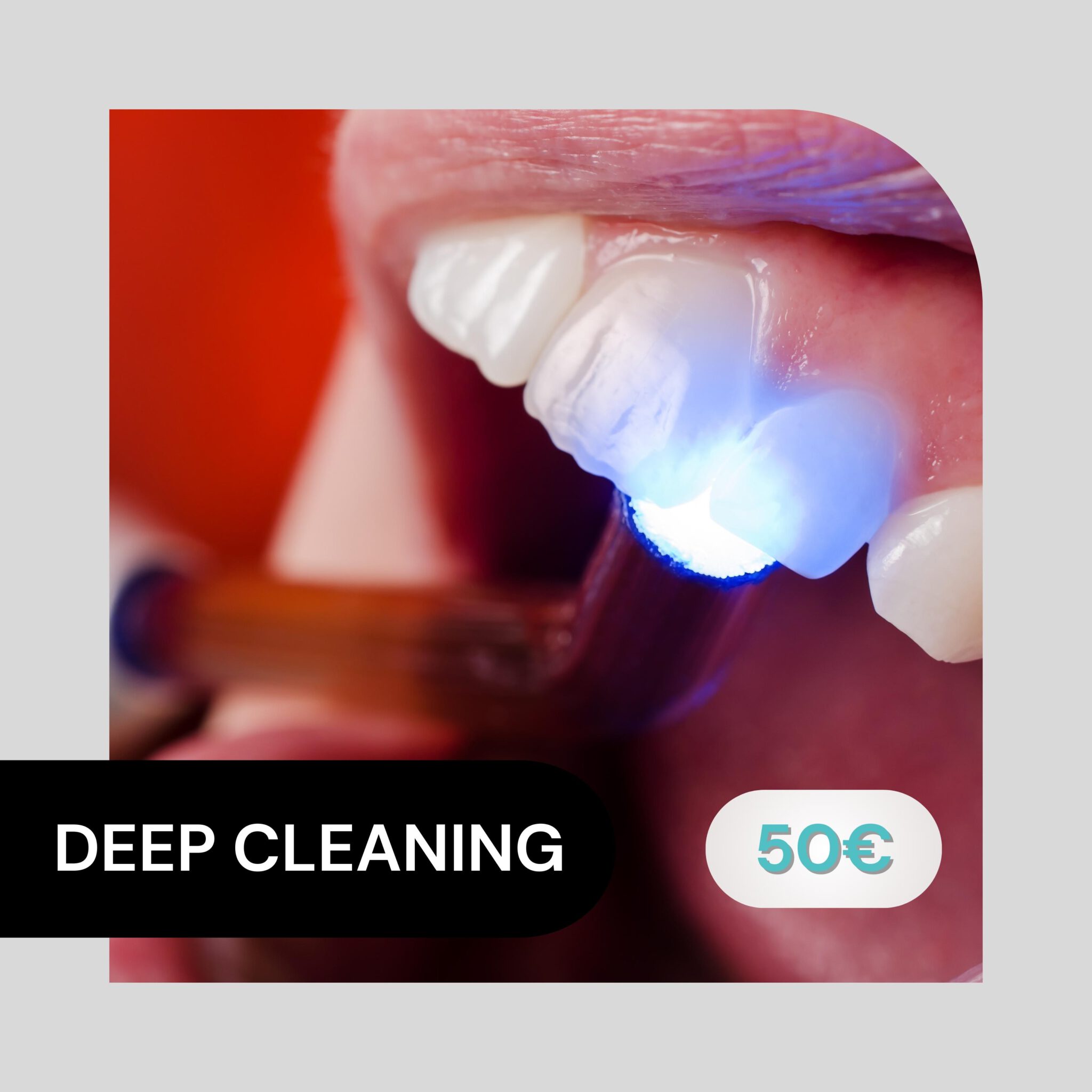 Deep Cleaning – Smile in Turkey