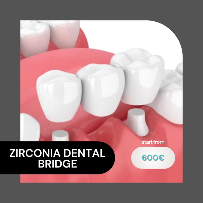 Zirconia Dental Bridge – Smile in Turkey